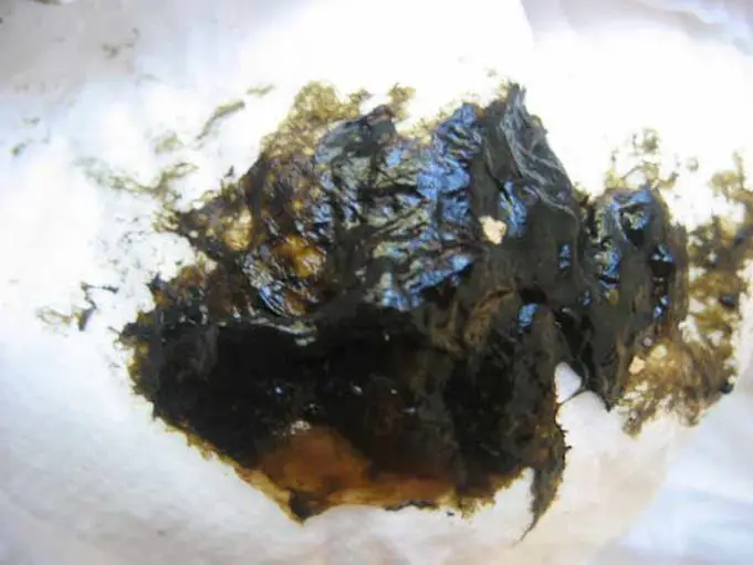 Black Tarry Stool Causes, Indications & Symptoms | CureHows